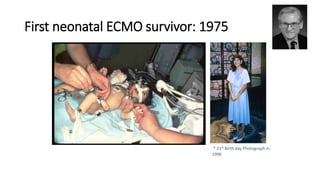 Ecmo | PPTX