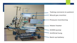Ecmo (Extracorporeal membrane oxygenation) | PPTX
