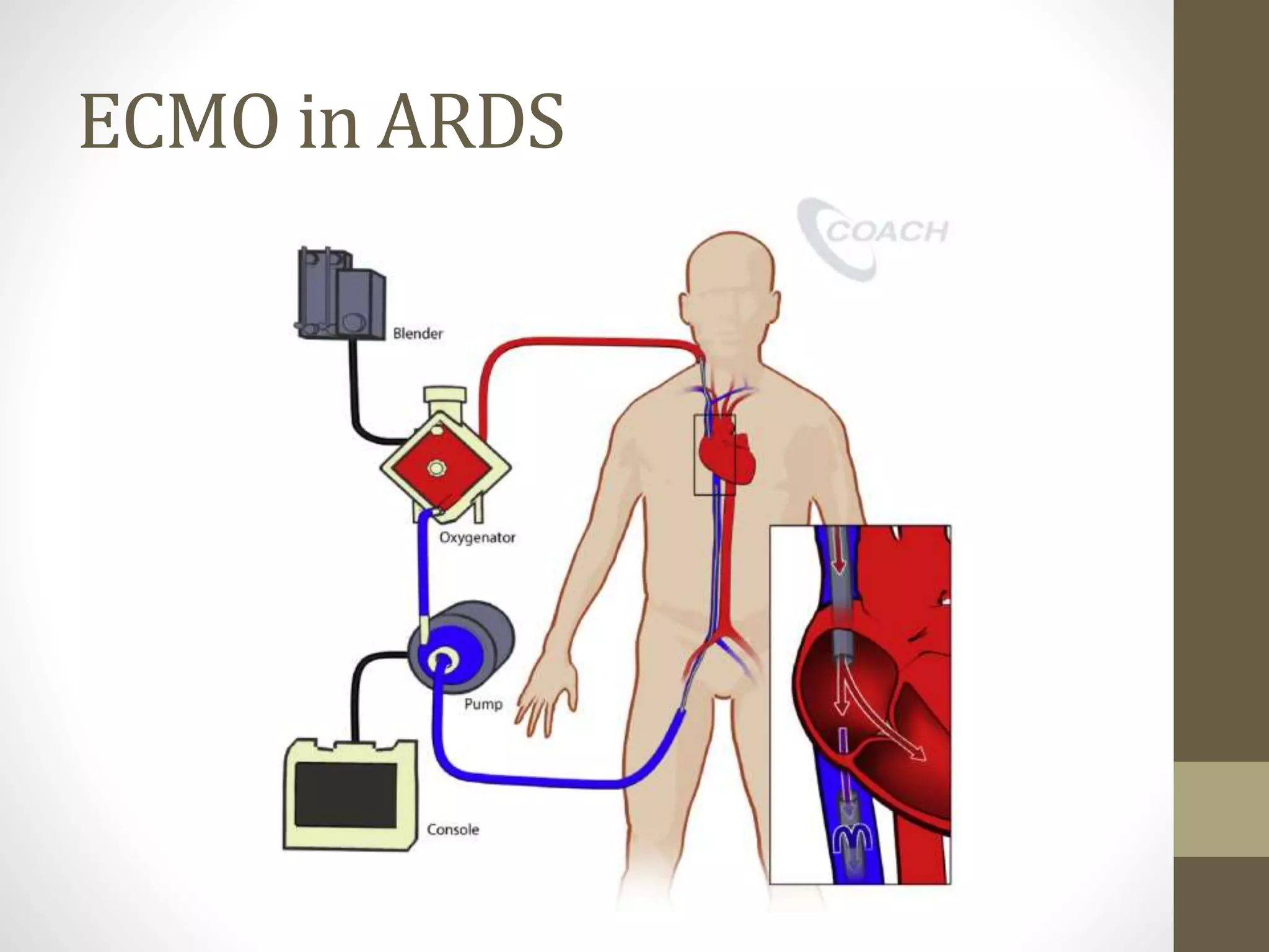 Ecmo | PPTX