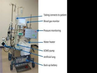 Ecmo Parts