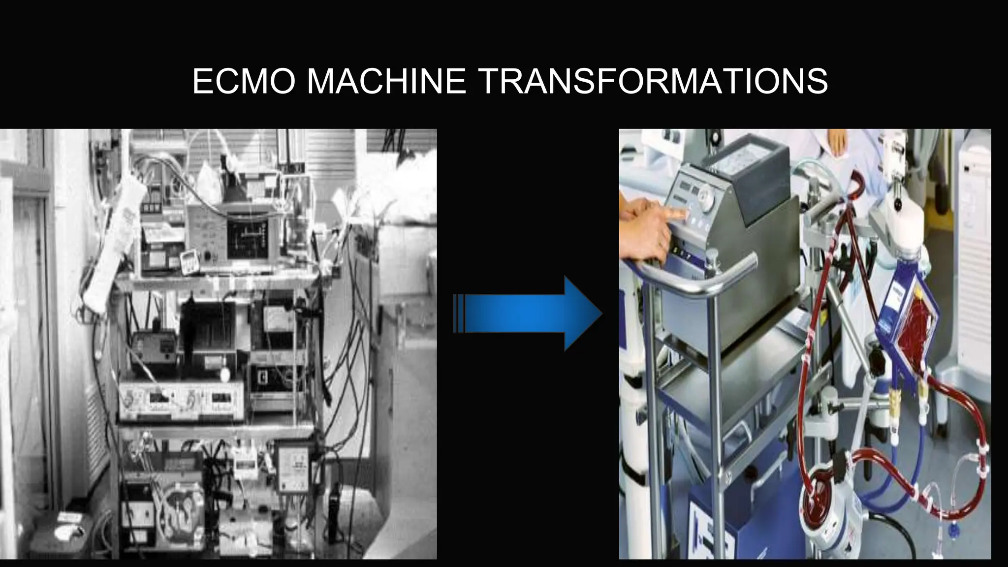 extracorporeal membrane oxygenation (ecmo) | PPTX
