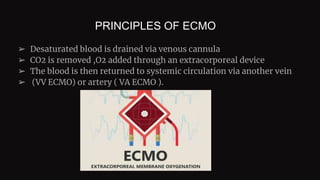 extracorporeal membrane oxygenation (ecmo) | PPTX