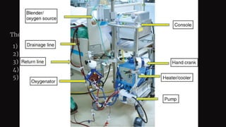 extracorporeal membrane oxygenation (ecmo) | PPTX