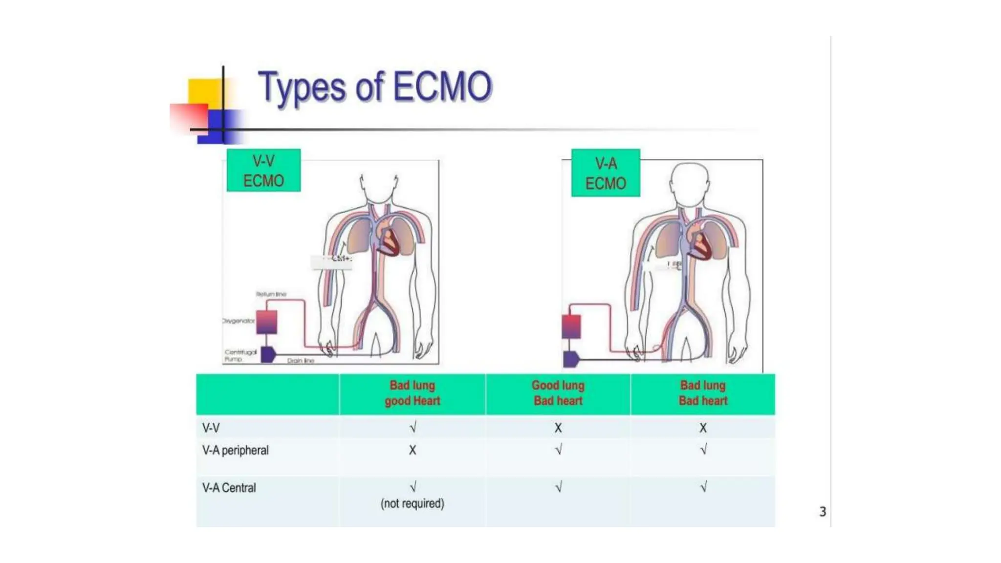 ecmo extracorporeal membrane oxygenarator | PPTX