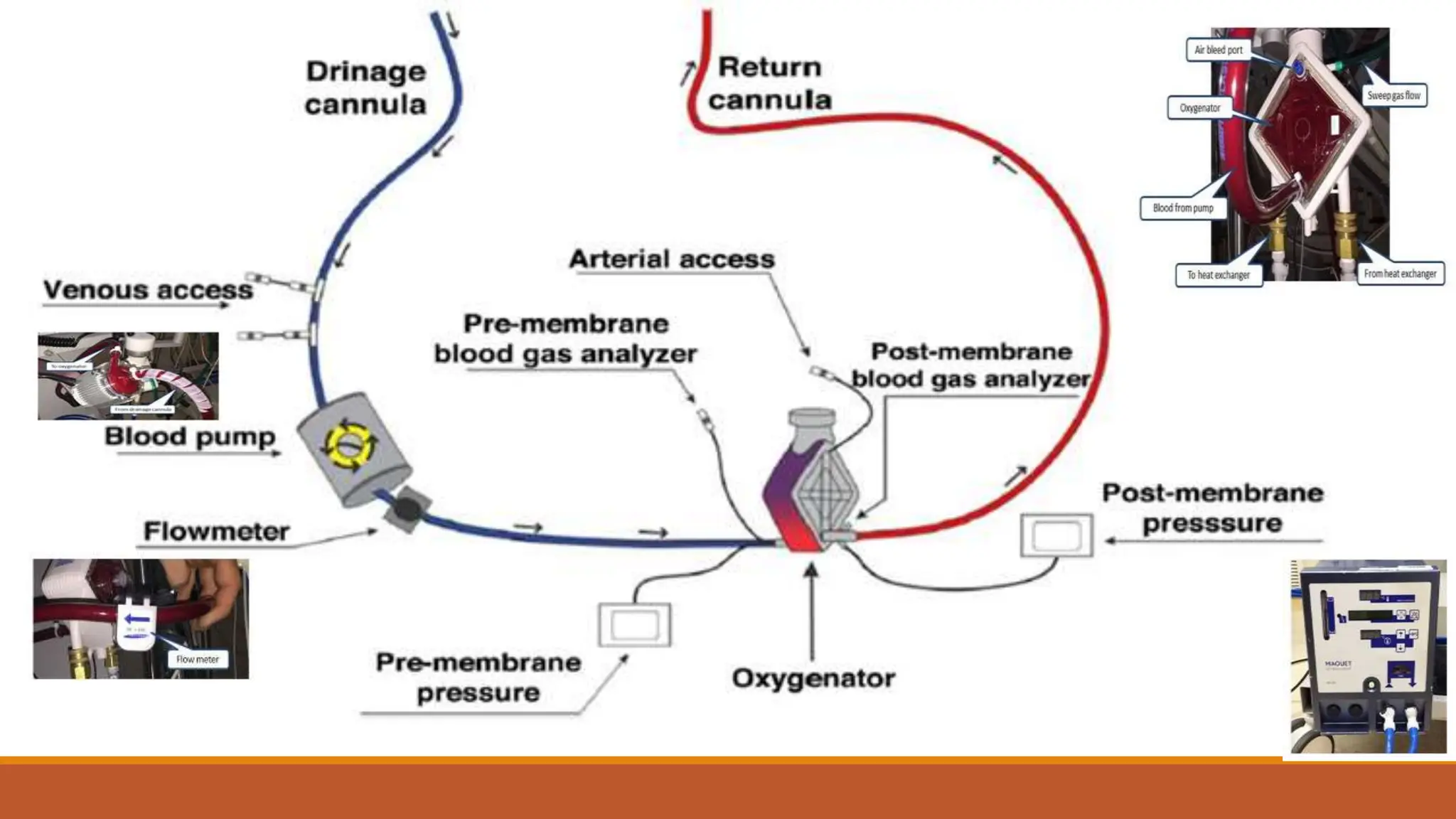 Extracorporeal Membrane Oxygenation (ECMO) | PPTX | Lung and Respiratory Health | Diseases and ...