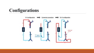 Extracorporeal Membrane Oxygenation (ECMO) | PPTX | Lung and ...