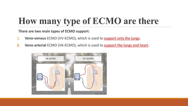 Extracorporeal Membrane Oxygenation (ECMO) | PPTX | Lung and Respiratory Health | Diseases and ...