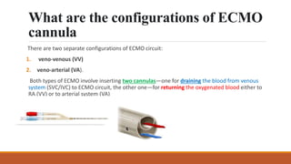 Extracorporeal Membrane Oxygenation (ECMO) | PPTX | Lung and ...