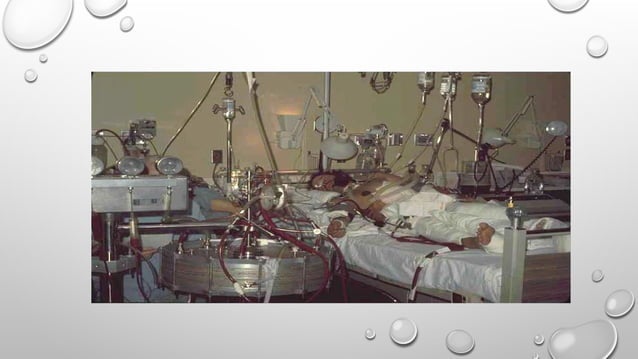 ECMO ecmo ecmo ecmo ecmoECMO ecmo ecmo ecmo ecmo | PPT