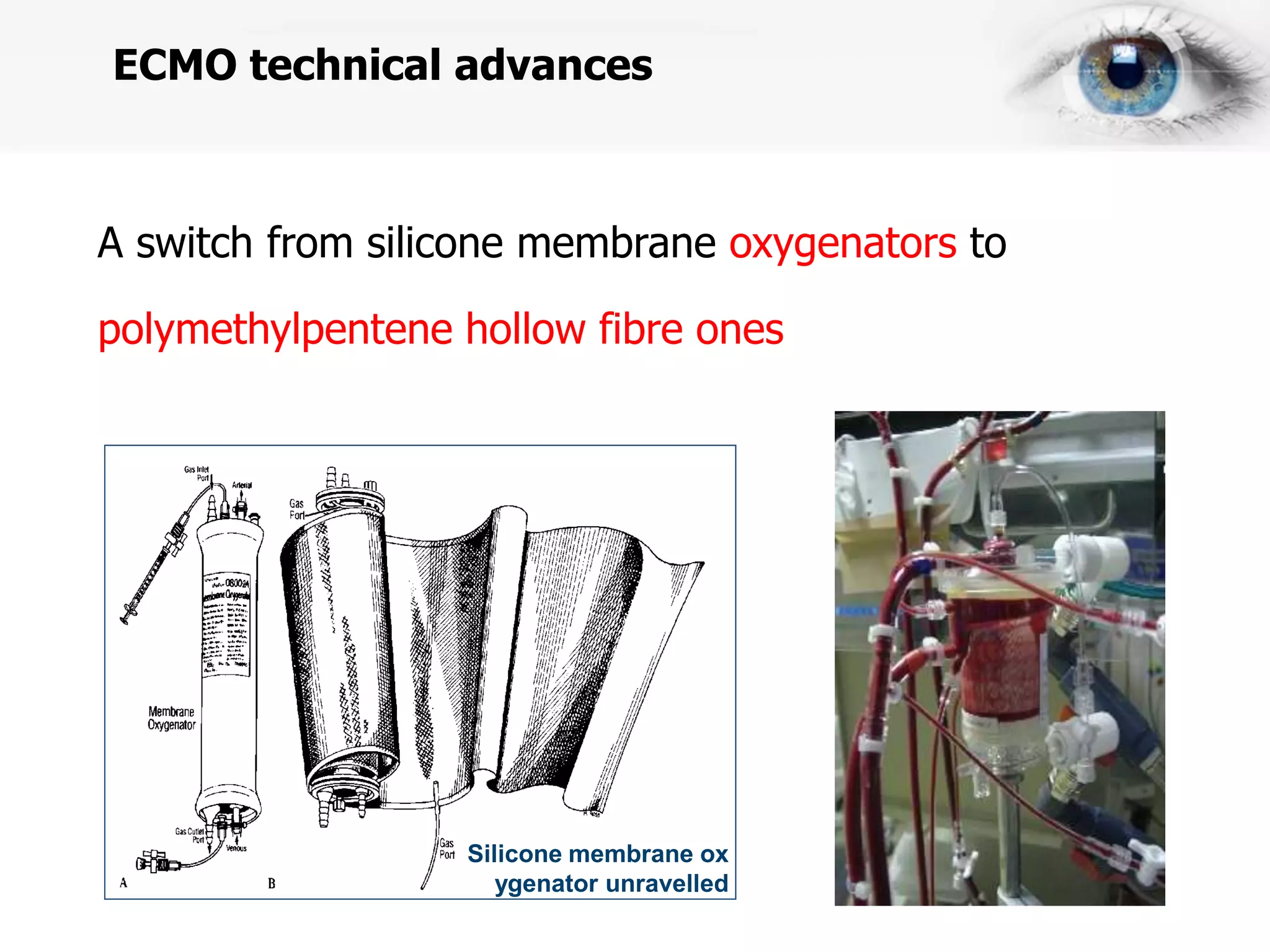 Ecmo dr himaaldev | PPTX