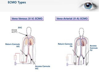 Ecmo dr himaaldev | PPT