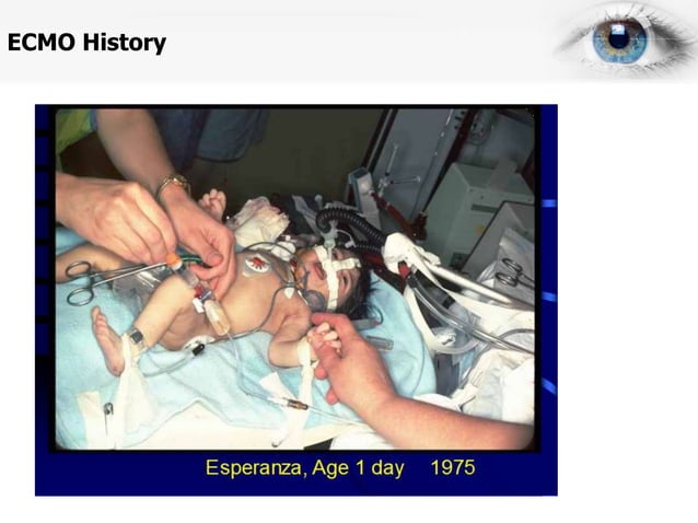 Ecmo dr himaaldev | PPT