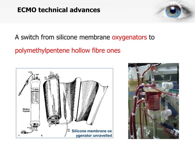 Ecmo dr himaaldev | PPT