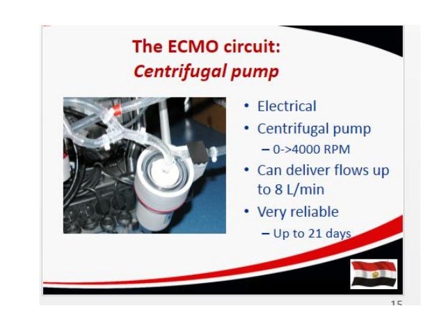 ECMO: Extracorporial Membrane Oxygenation