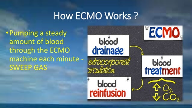 Ecmo nurse presentation | PPTX | Lung and Respiratory Health | Diseases ...