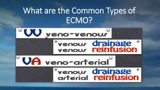 Ecmo nurse presentation | PPTX