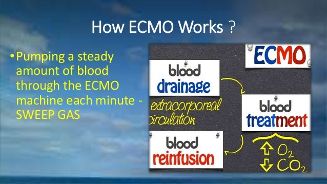 Ecmo nurse presentation