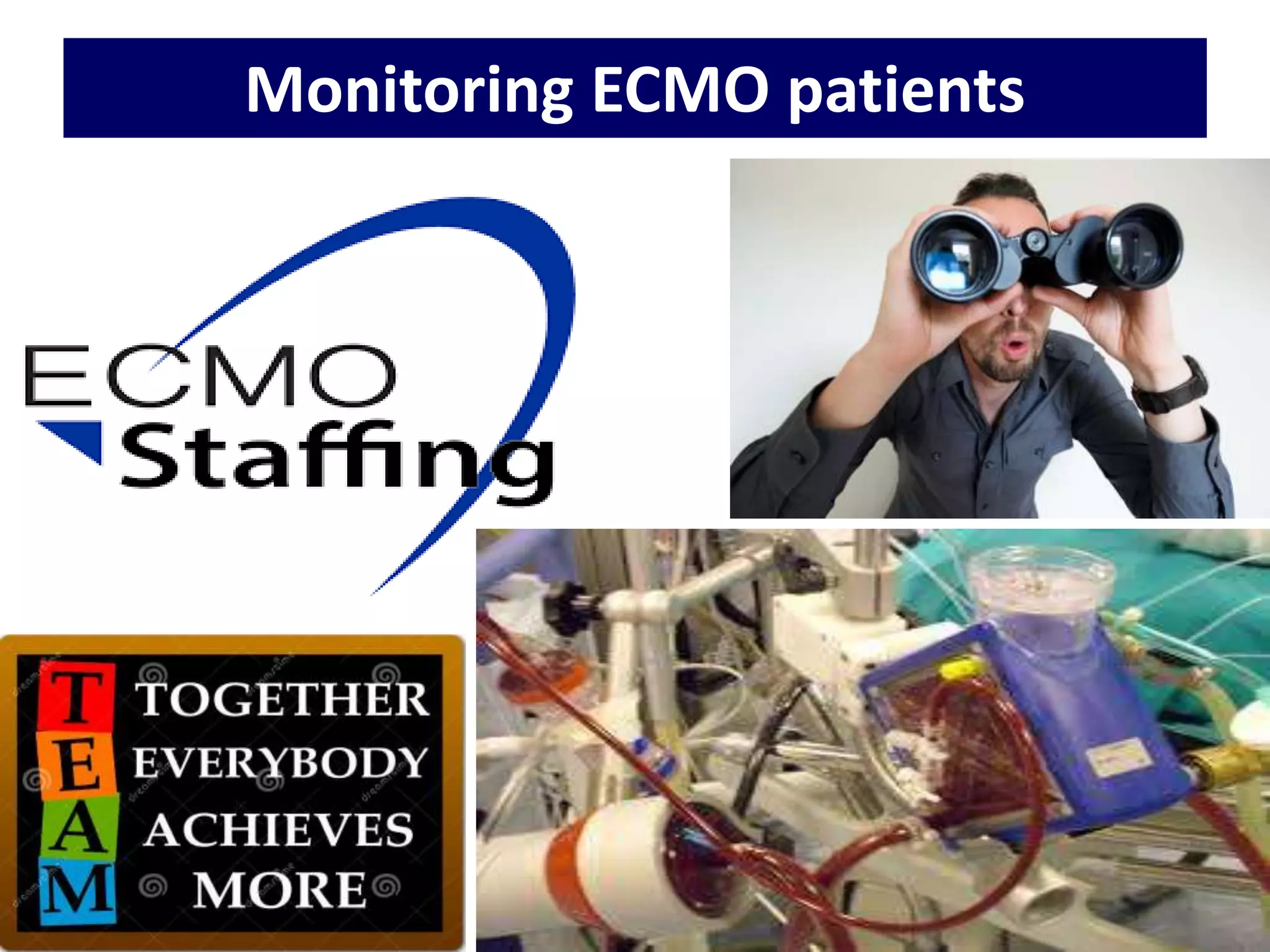 ECMO part 2 by Dr.Tinku Joseph | PPTX