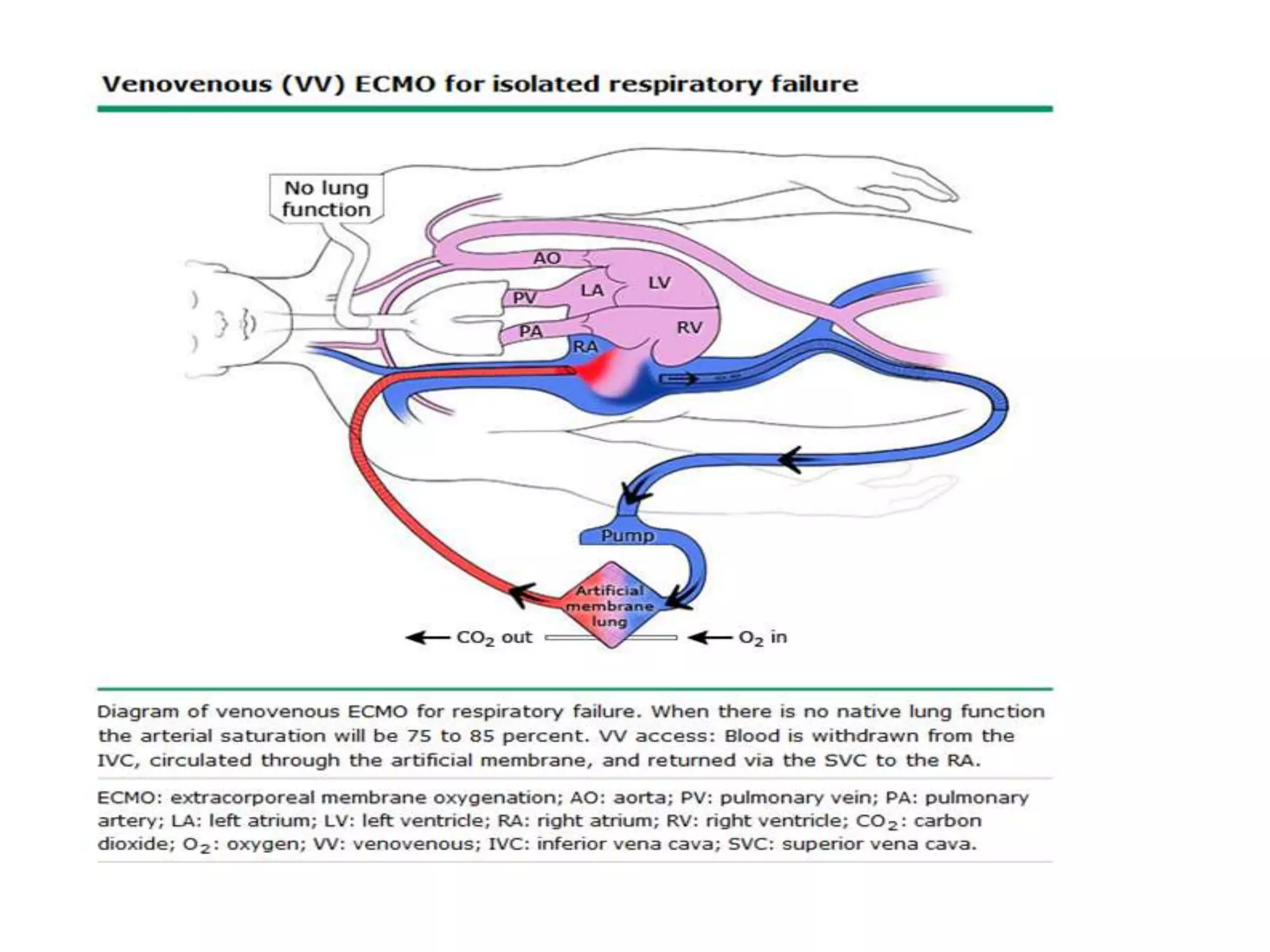 ECMO | PPTX
