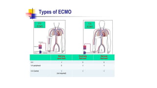 ECMO.pptx
