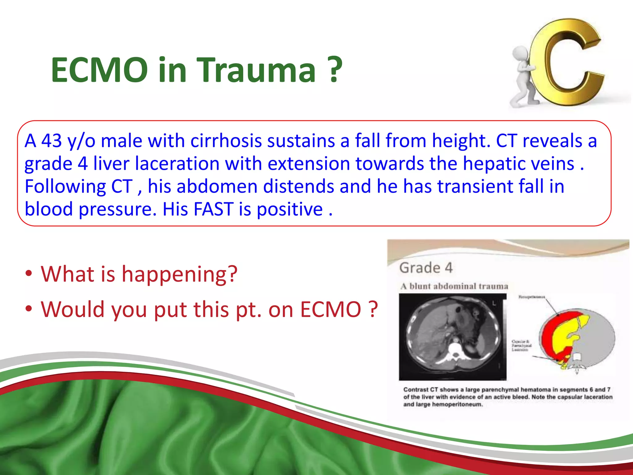ECMO and its emerging role in trauma ICU 15th ECCC Dubai April 2019 | PPTX