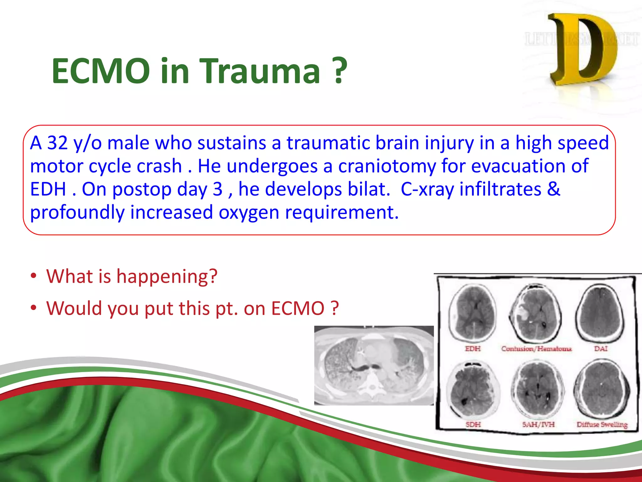ECMO and its emerging role in trauma ICU 15th ECCC Dubai April 2019 | PPTX