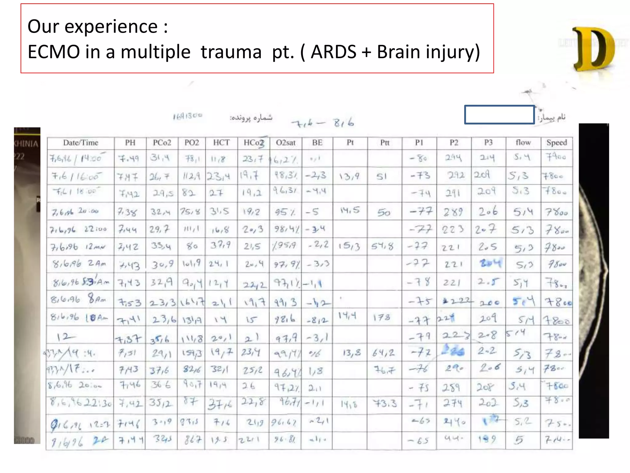 ECMO and its emerging role in trauma ICU 15th ECCC Dubai April 2019 | PPTX