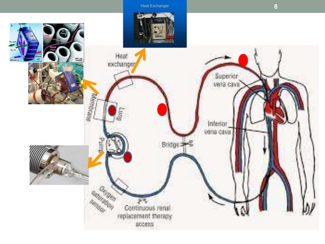 ECMO and its emerging role in trauma ICU 15th ECCC Dubai April 2019 | PPTX