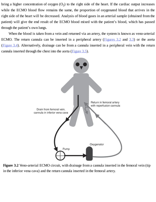 Ecmo book | PDF