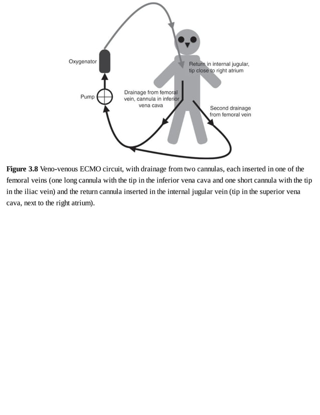 Ecmo book | PDF