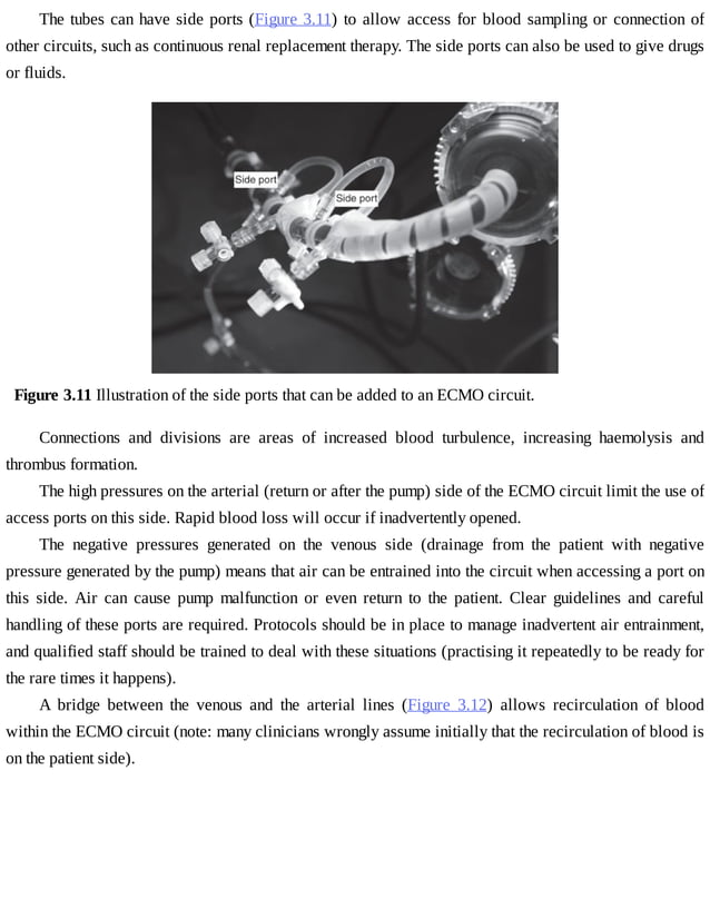 Ecmo book | PDF