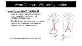 ECMO by DJ | PPT