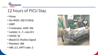 ECMO case scenarios (Venovenous and Venoarterial).pptx