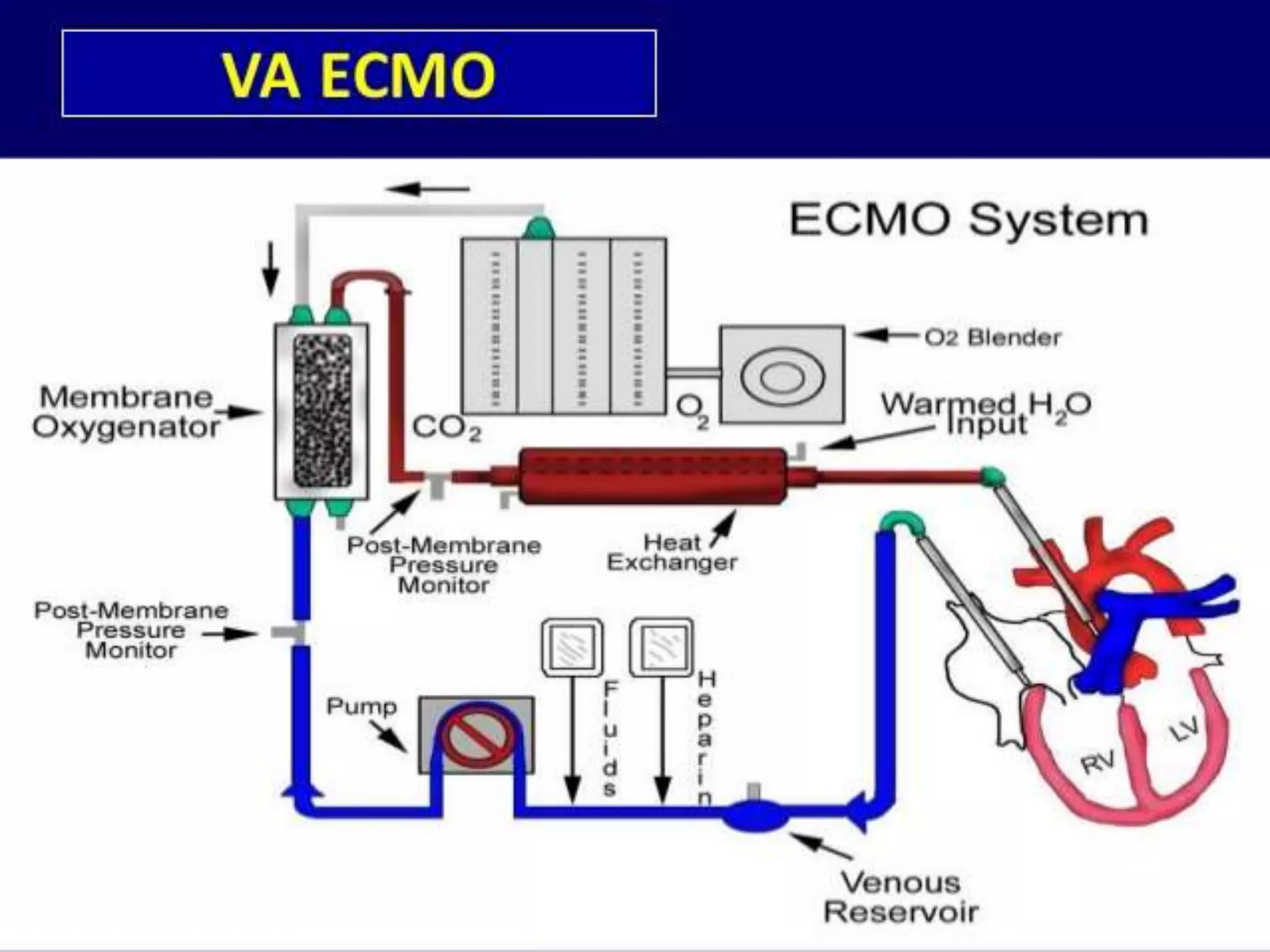 Ecmo and crrt | PPTX