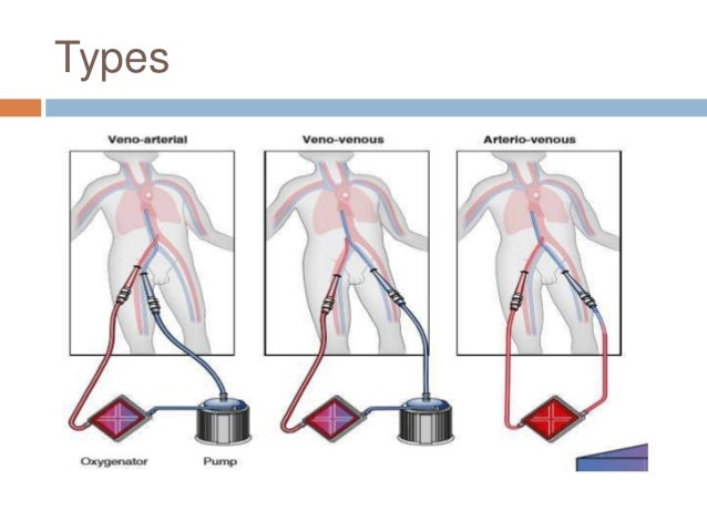 Ecmo and crrt