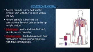Ecmo ( extracorporeal membrane oxygenation ) | PPTX