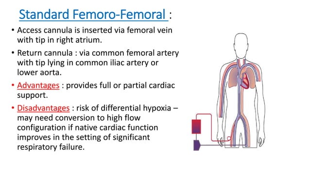ECMO - extracorporeal membrane oxygenation | PPTX | Lung and ...