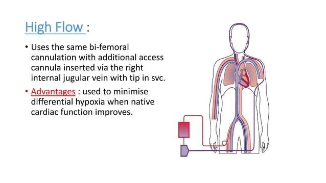 ECMO - extracorporeal membrane oxygenation | PPTX | Lung and ...