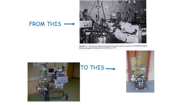 ECMO - extracorporeal membrane oxygenation | PPTX | Lung and ...