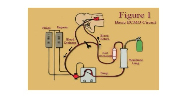 ECMO - extracorporeal membrane oxygenation