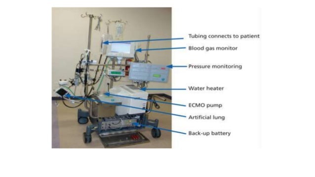 ECMO - extracorporeal membrane oxygenation