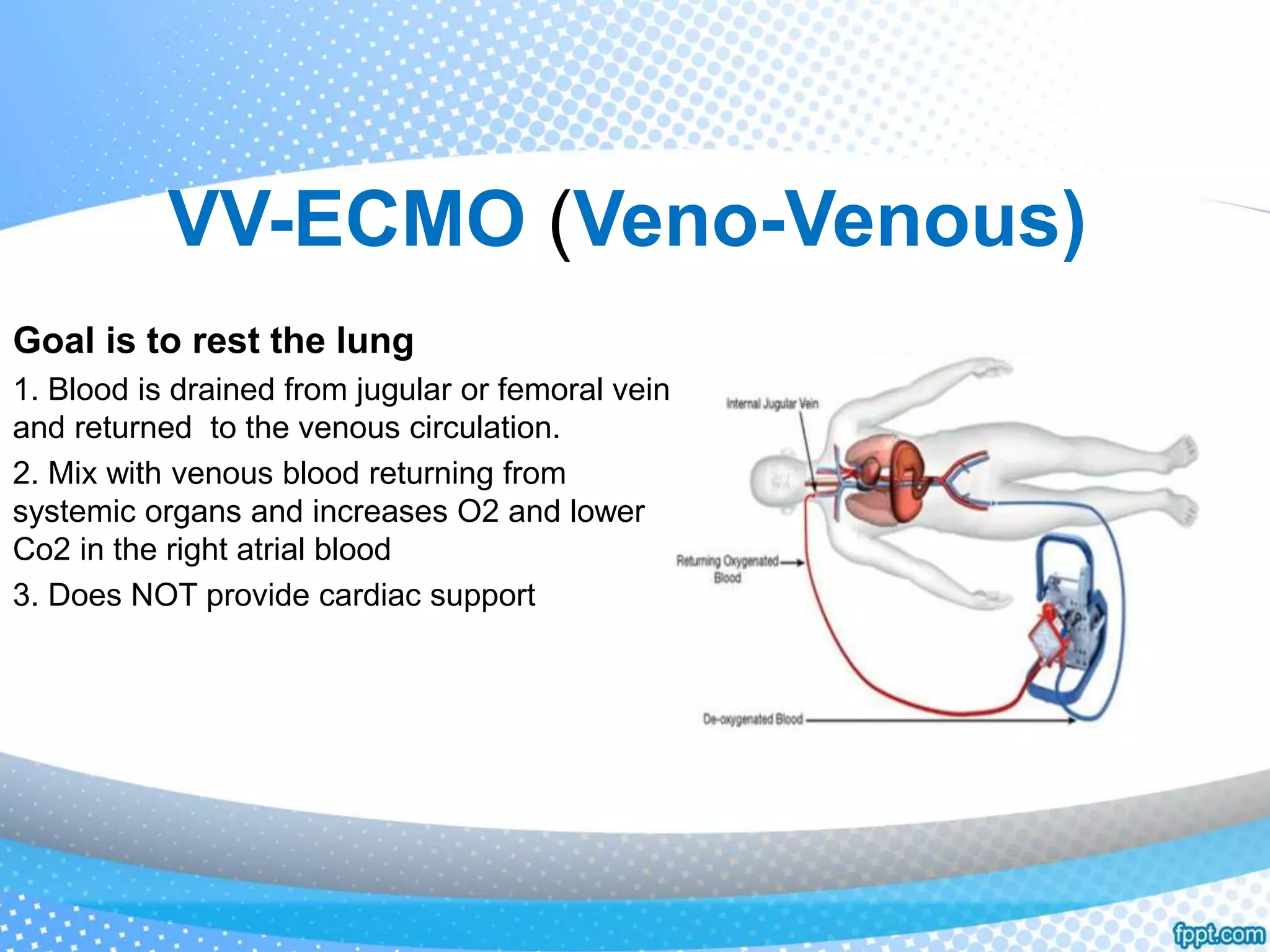 Ecmo | PPTX