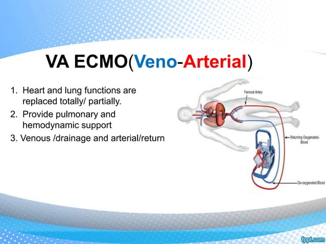Ecmo | PPTX