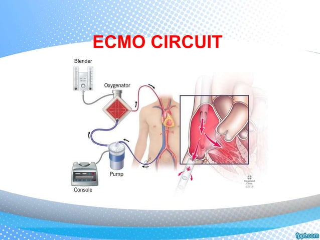 Ecmo | PPTX