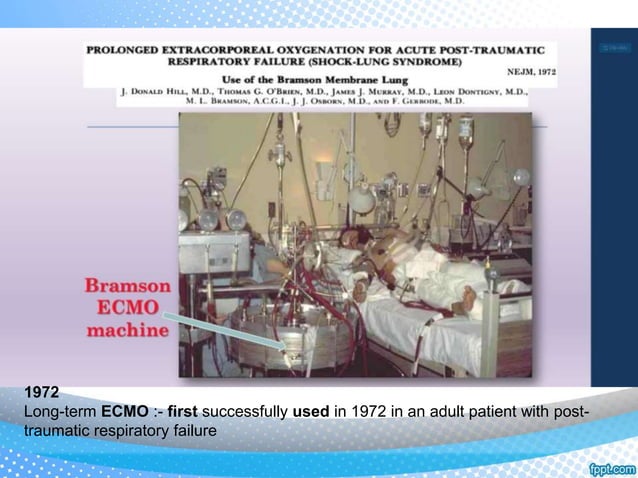 Ecmo | PPTX