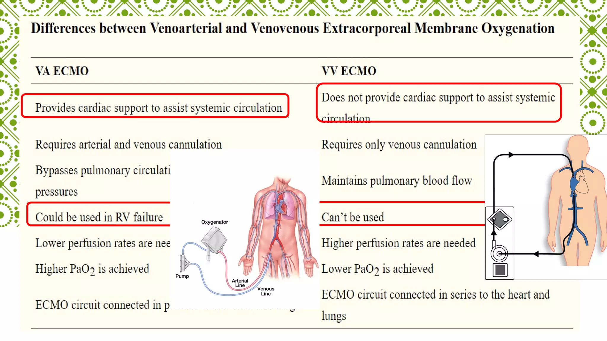 Ecmo history, indications, cannulation, complications | ODP