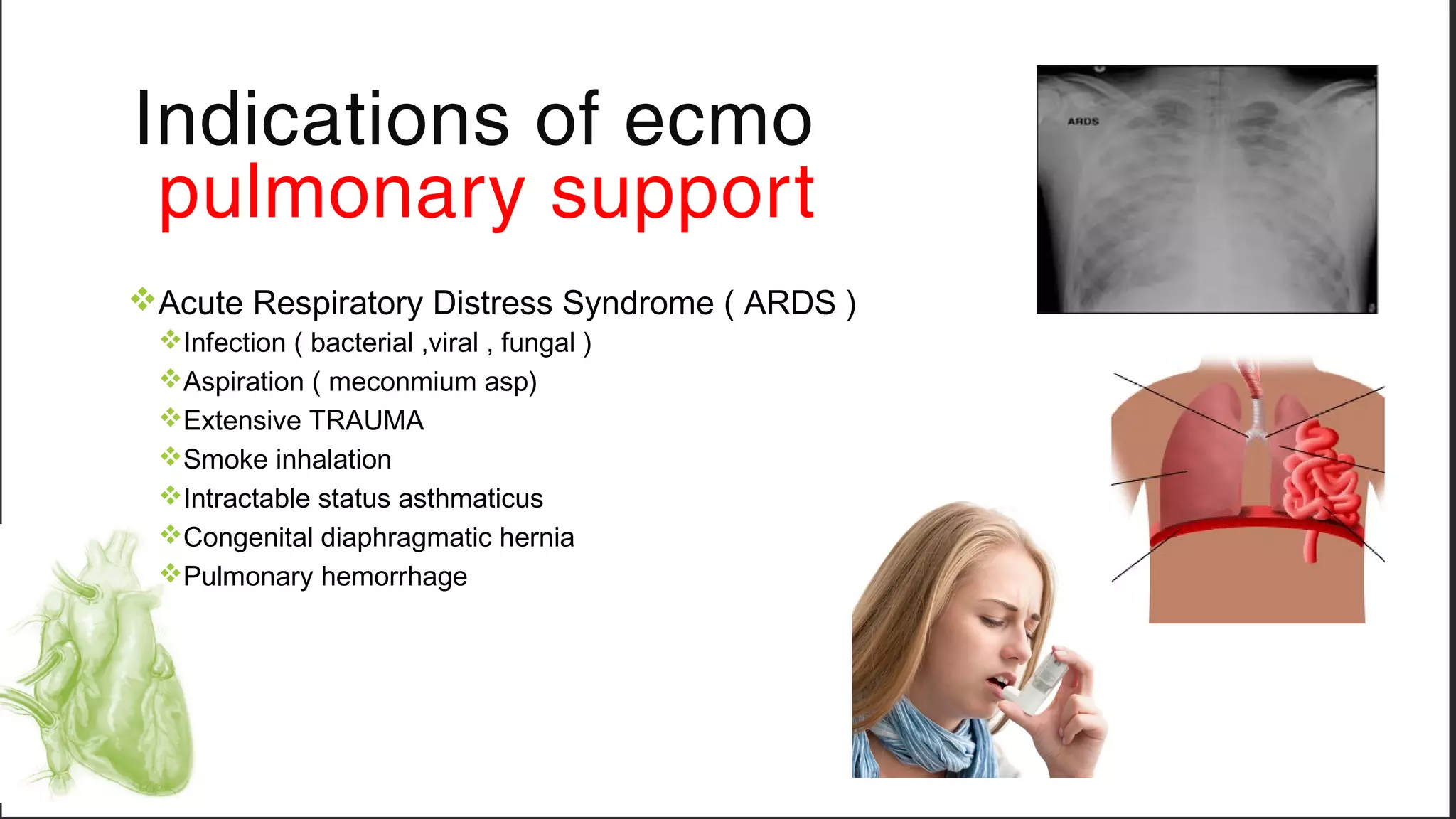 Ecmo history, indications, cannulation, complications | ODP