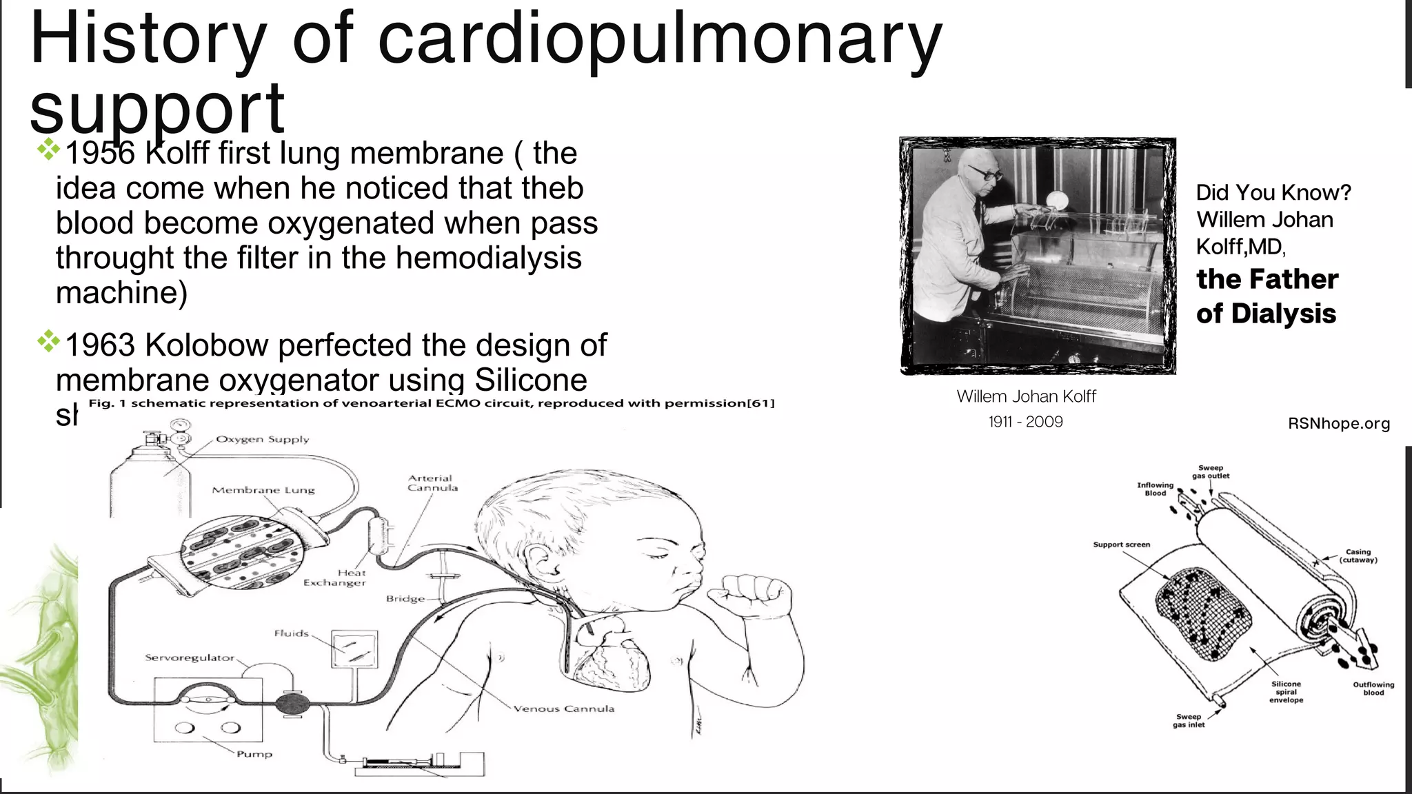Ecmo history, indications, cannulation, complications | ODP