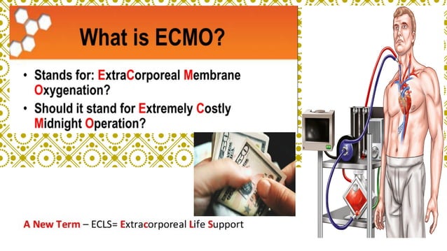 Ecmo history, indications, cannulation, complications | ODP | Lung and ...