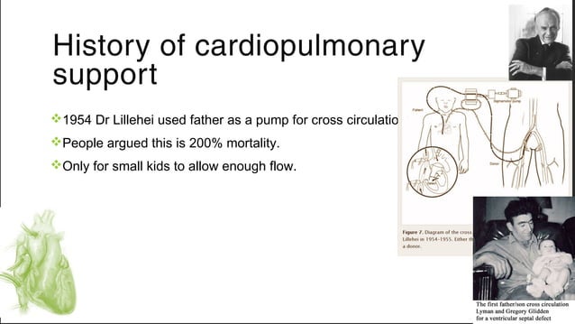 Ecmo history, indications, cannulation, complications | ODP | Lung and ...
